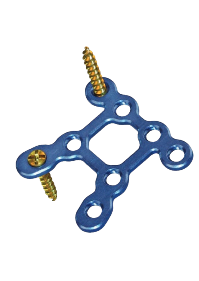 Torácico – Implantartis